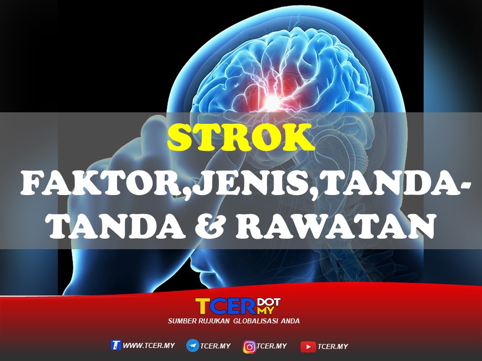 Penyakit Strok- Faktor,Jenis,Tanda-Tanda Dan Rawatan - TCER.MY