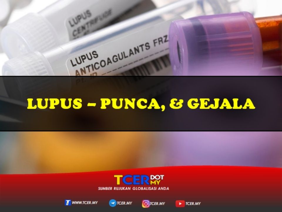 Lupus - Punca, Jenis Dan Gejala - TCER.MY