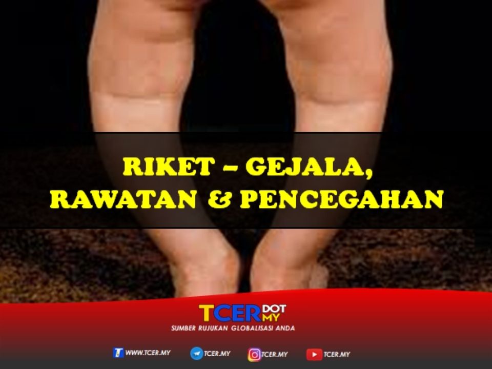 Riket - Gejala, Rawatan Dan Pencegahan - TCER.MY
