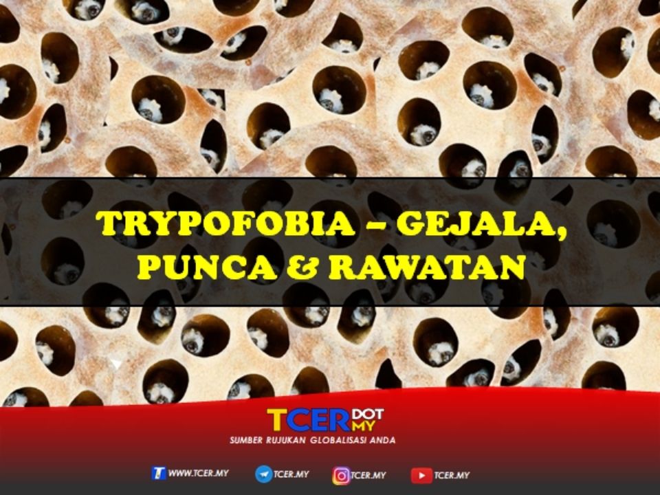 Trypofobia - Gejala, Punca Dan Rawatan - TCER.MY