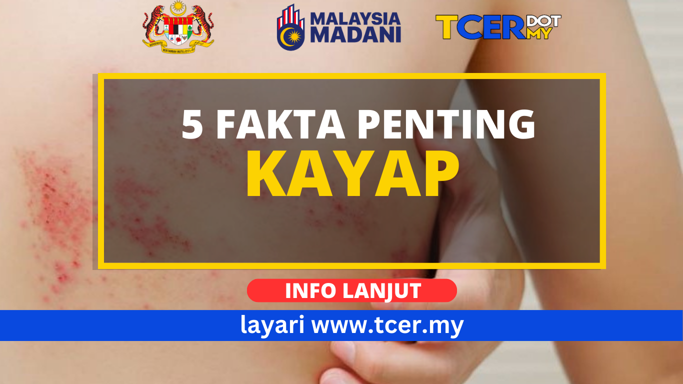 Kayap: 5 Fakta Ramai Orang Tak Tahu - TCER.MY