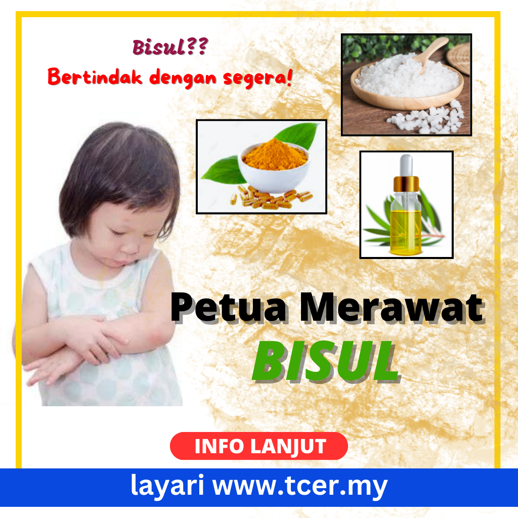 Petua Merawat Bisul Dengan Mudah : Lakukan 5 Perkara Ini! - TCER.MY