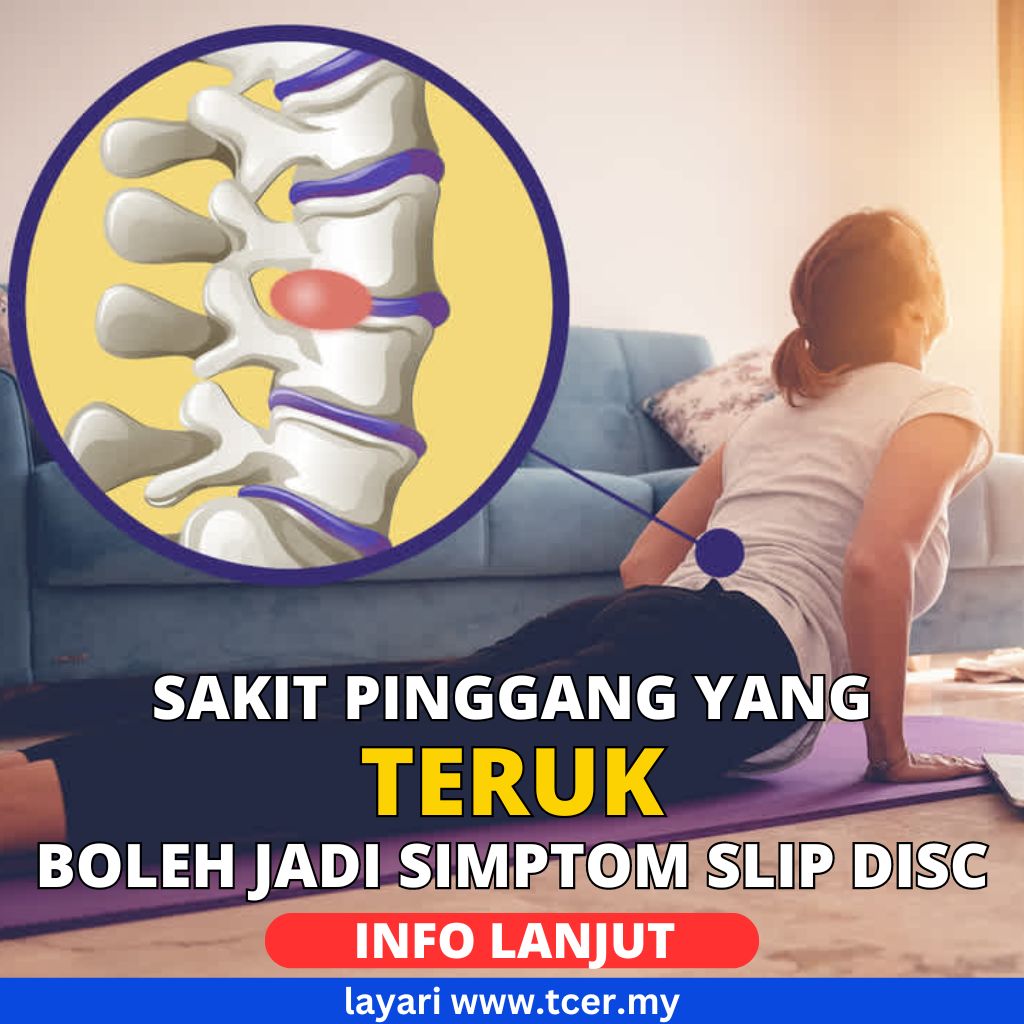 3 Simptom Utama Slip Disc, Sakit Belakang Yang Perlu Ambil Peduli - TCER.MY