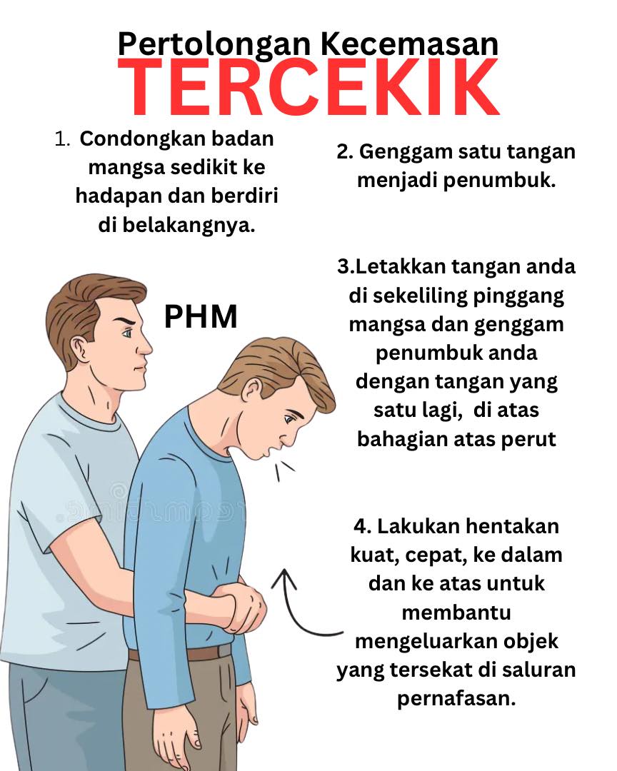 Panduan Teknik 'Heimlich Maneuver' Ketika Kecemasan Tercekik - TCER.MY