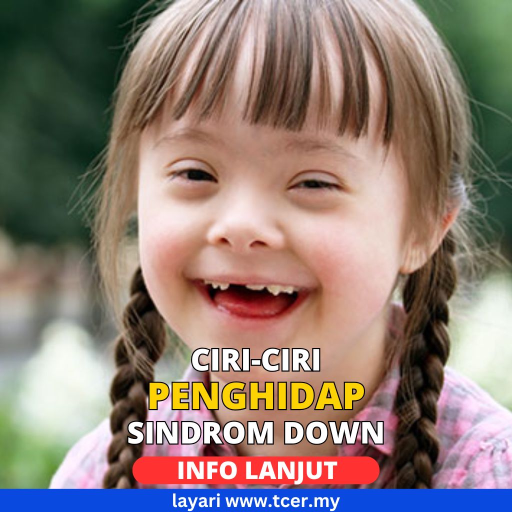 Apa Itu Sindrom Down? Adakah Ia Boleh Diwarisi & Dikesan Lebih Awal ...