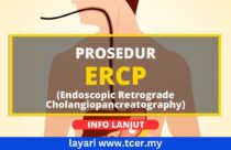 Penyakit Sawan (Epilepsi)- Punca,Tanda, Rawatan Dan Juga Pencegahan ...