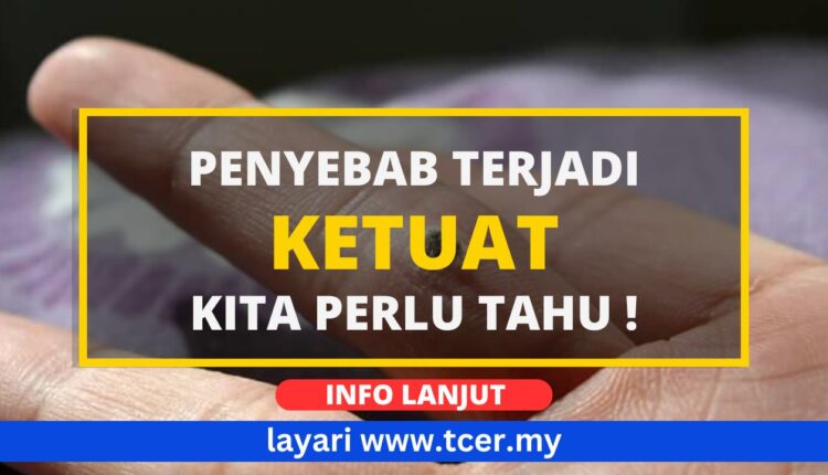 Ketuat: Jenis, Punca, Faktor Risiko, Simptom, Diagnosis & Pencegahan ...